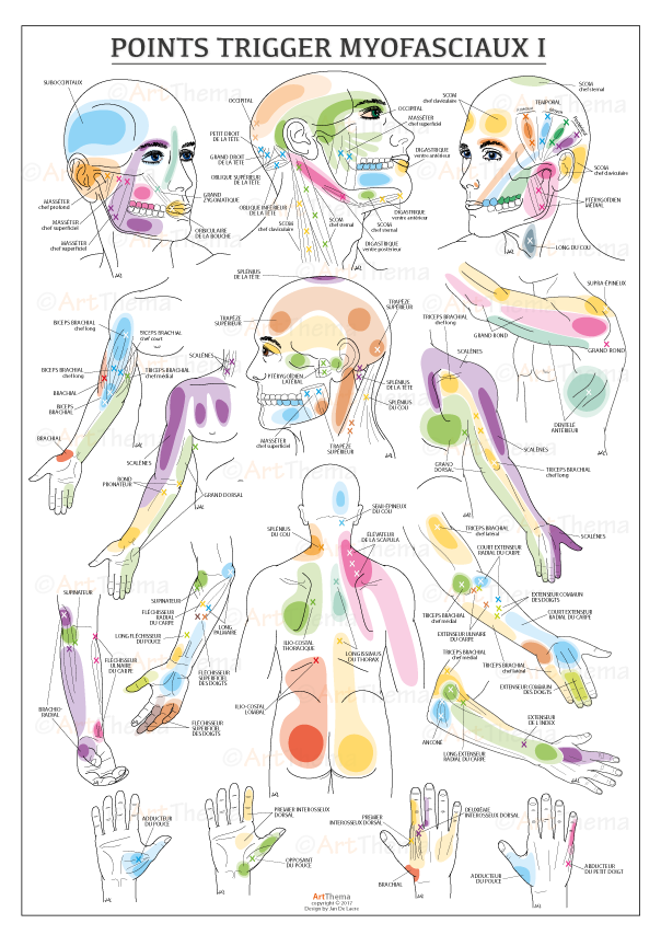 Points Trigger Myofasciaux